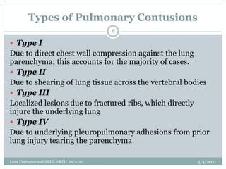 Lung contusion and ARDS | PPTX