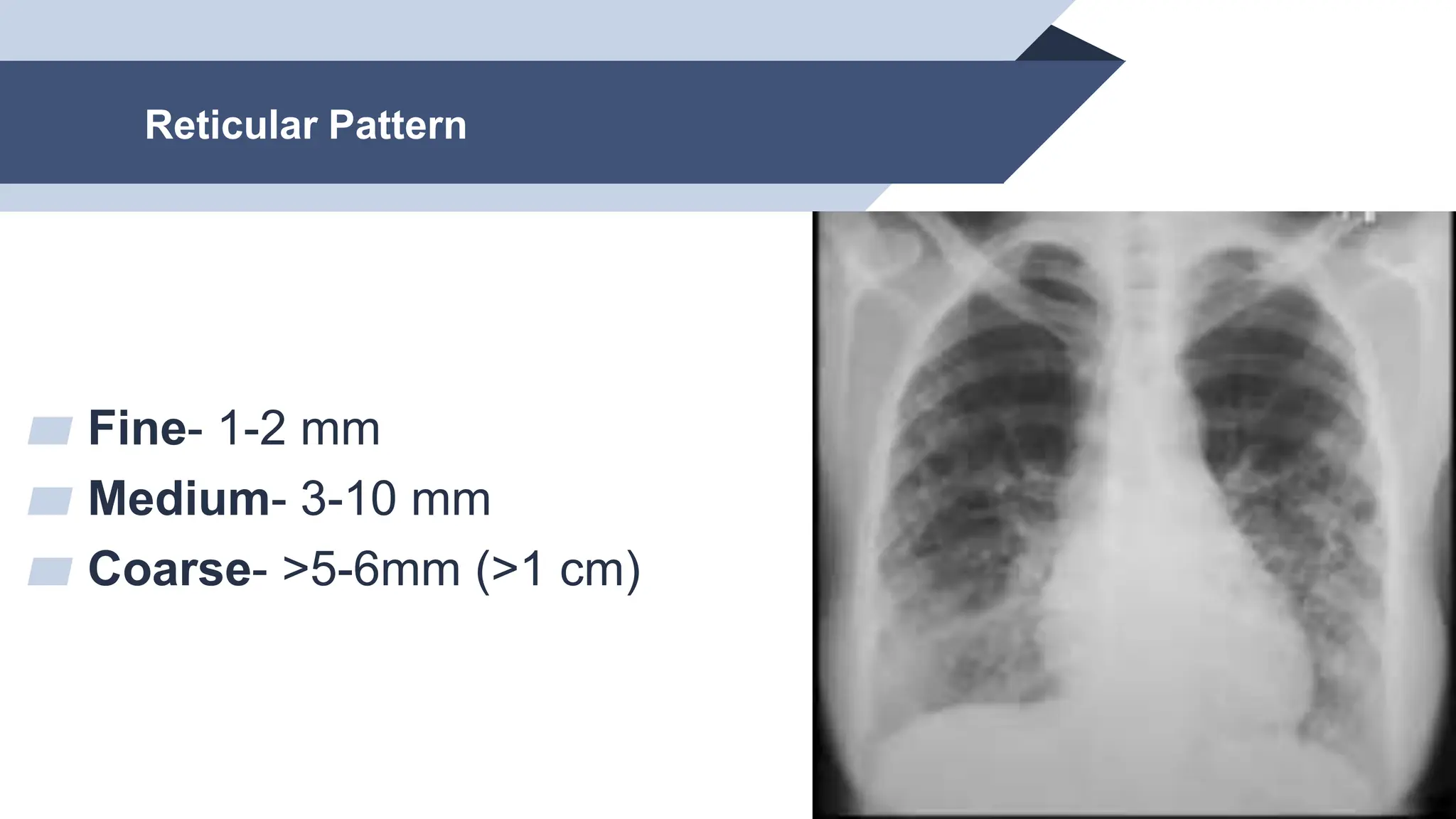 Imaging /radiographic findings of Lung Densities.pptx