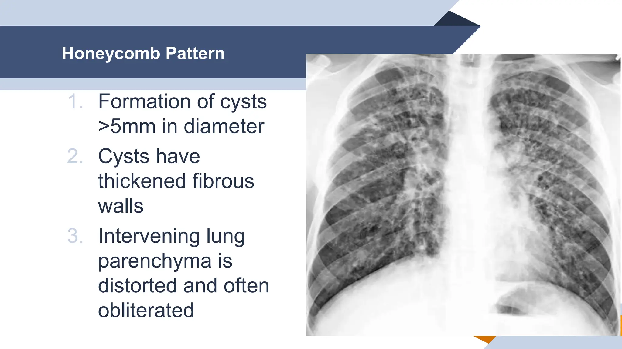 Imaging /radiographic findings of Lung Densities.pptx