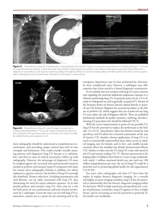 Lung ultrasound essential for BLUE protocol | PDF