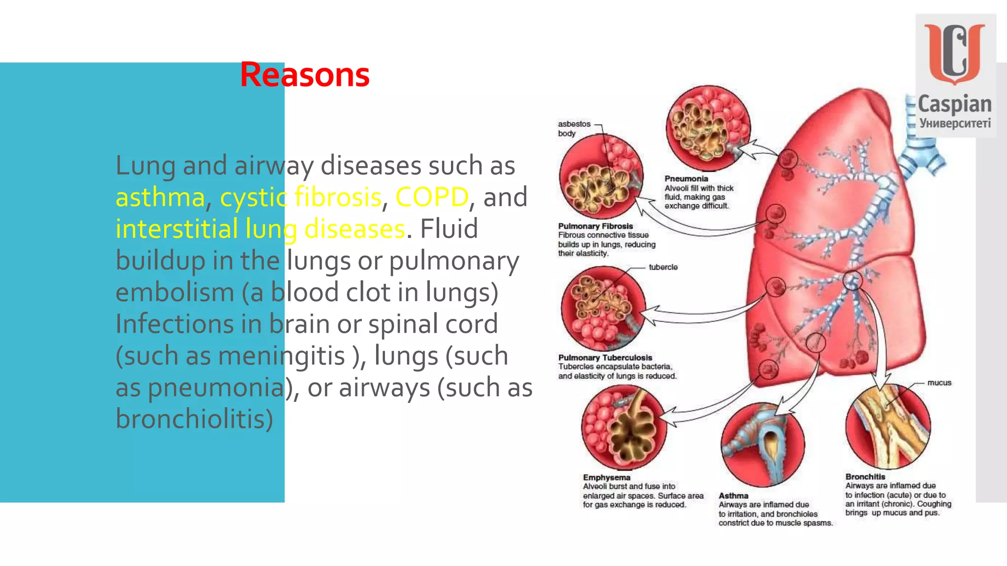 Lung Failure And AORTIC INSUFFICIENCY.pptx