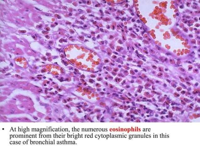 presentation of aotopsy of LUNG GROSSING .pptx