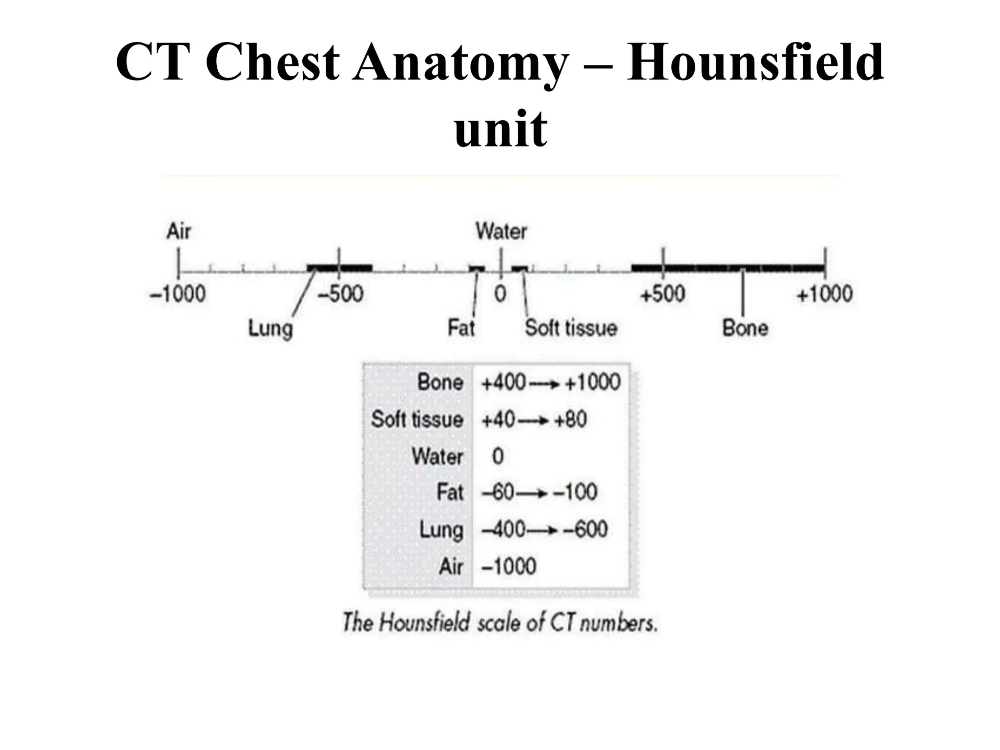 LUNG IMAGING CT SCAN with classification.pptx