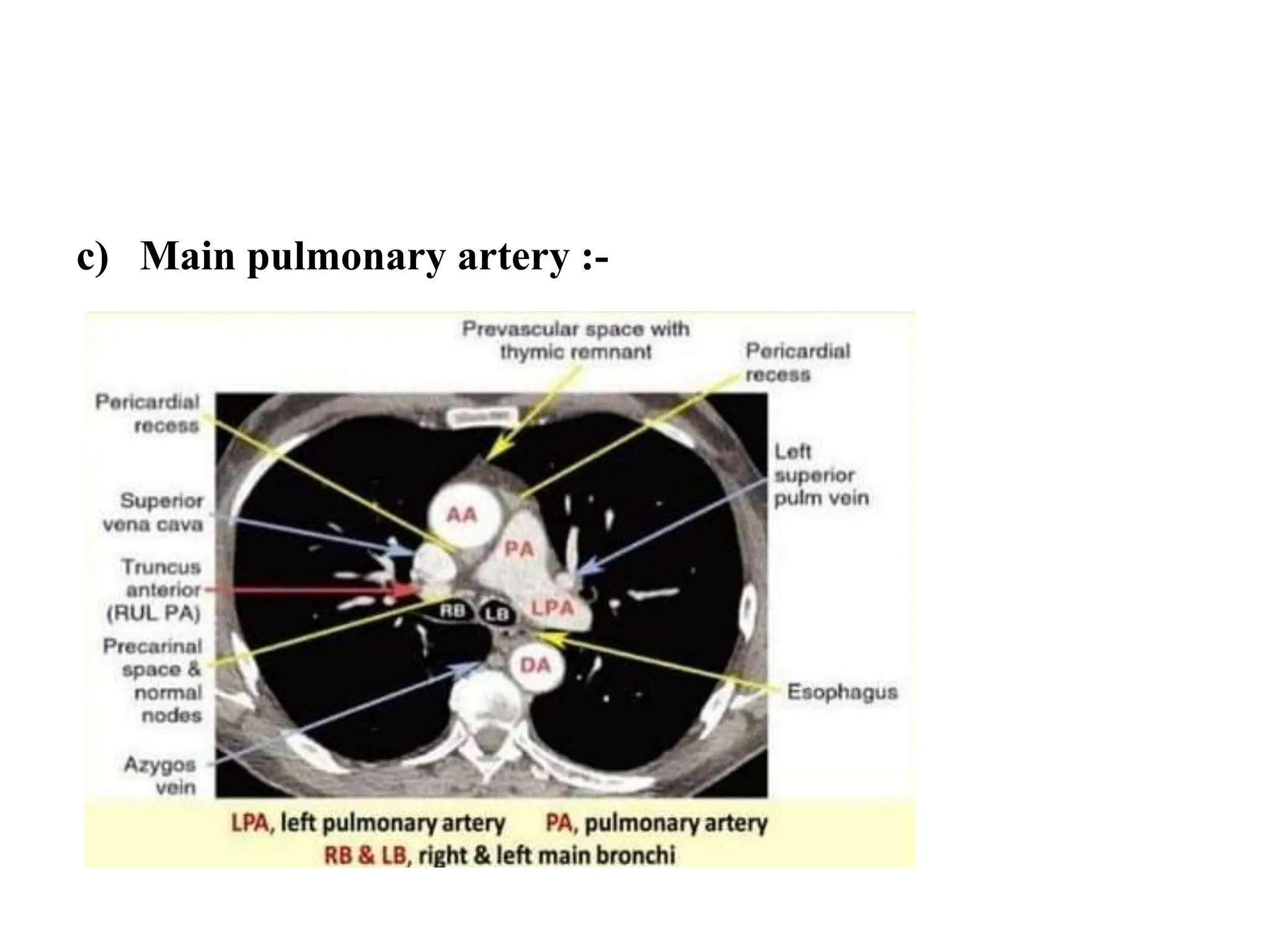 LUNG IMAGING CT SCAN with classification.pptx
