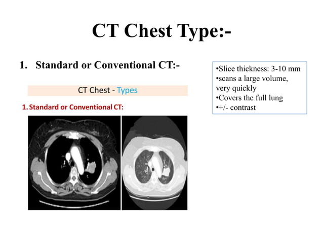 LUNG IMAGING CT SCAN with classification.pptx