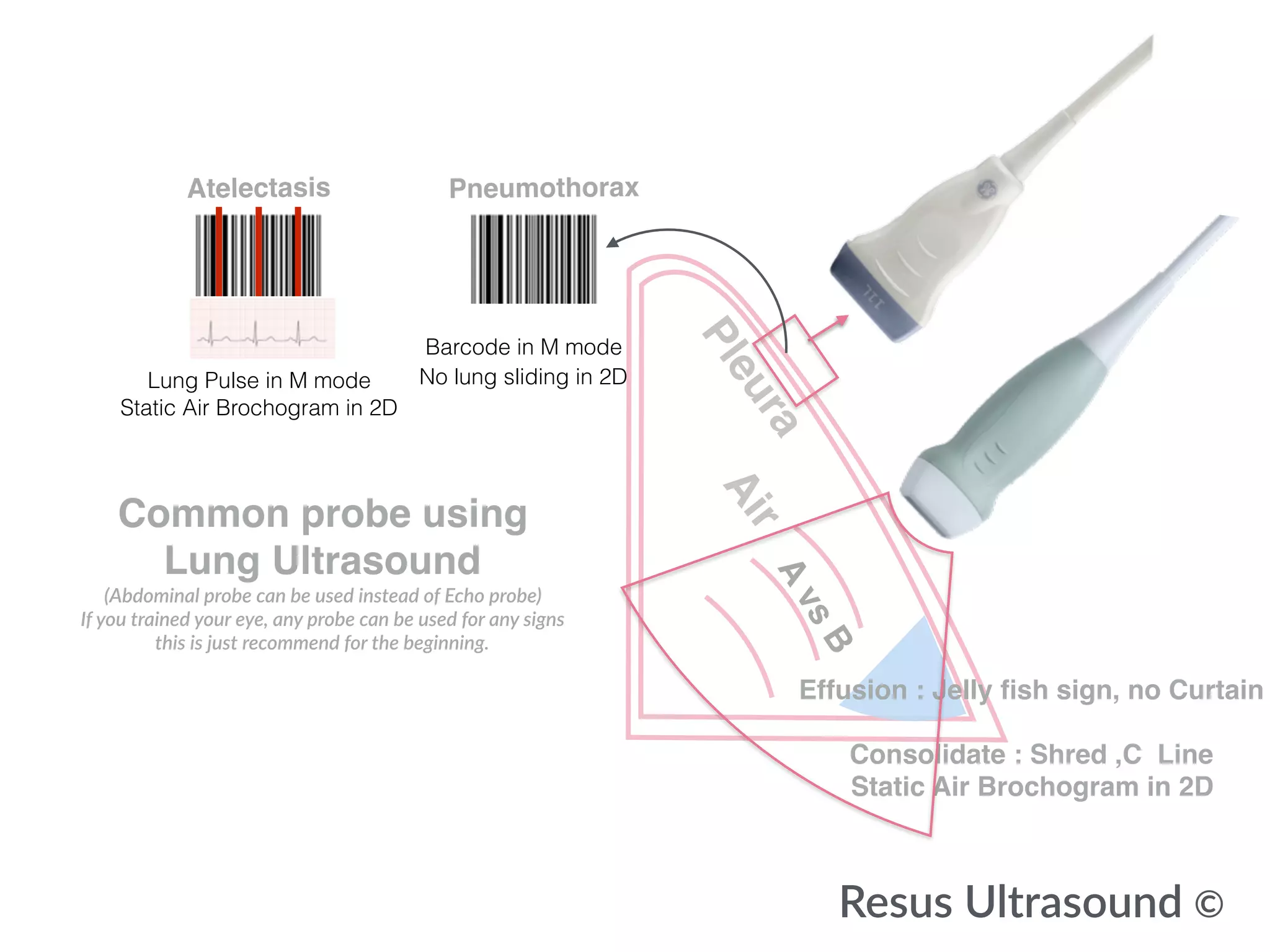 Simplified Lung Ultrasound | PDF