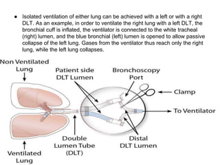 LUNG ISOLATION techniques and one lung ventilation | PPTX