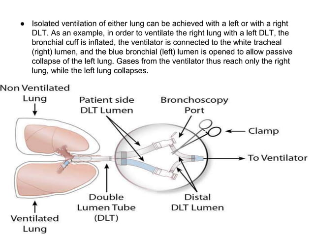 LUNG ISOLATION techniques and one lung ventilation | PPTX