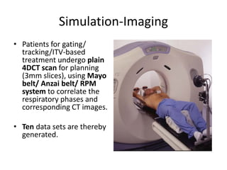 Motion Management in Lung Cancer Radiotherapy | PDF
