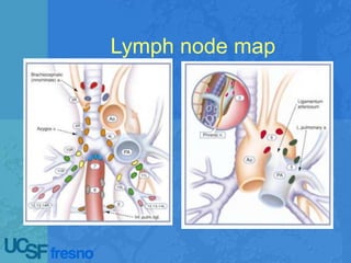 Echoendoscopic Lymph Node Staging in Lung Cancer: An endoscopic alternative | PPT