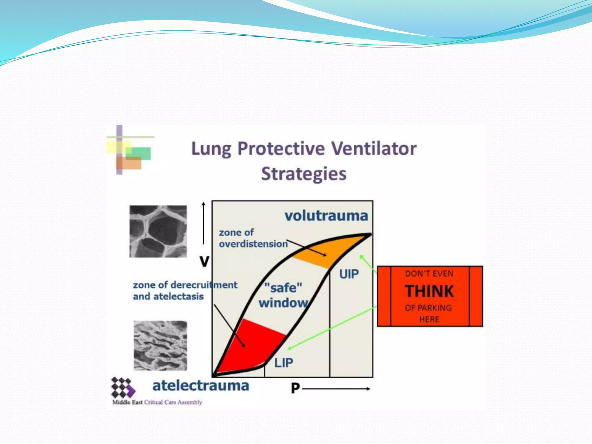 Lung Protective Ventilation | PPTX
