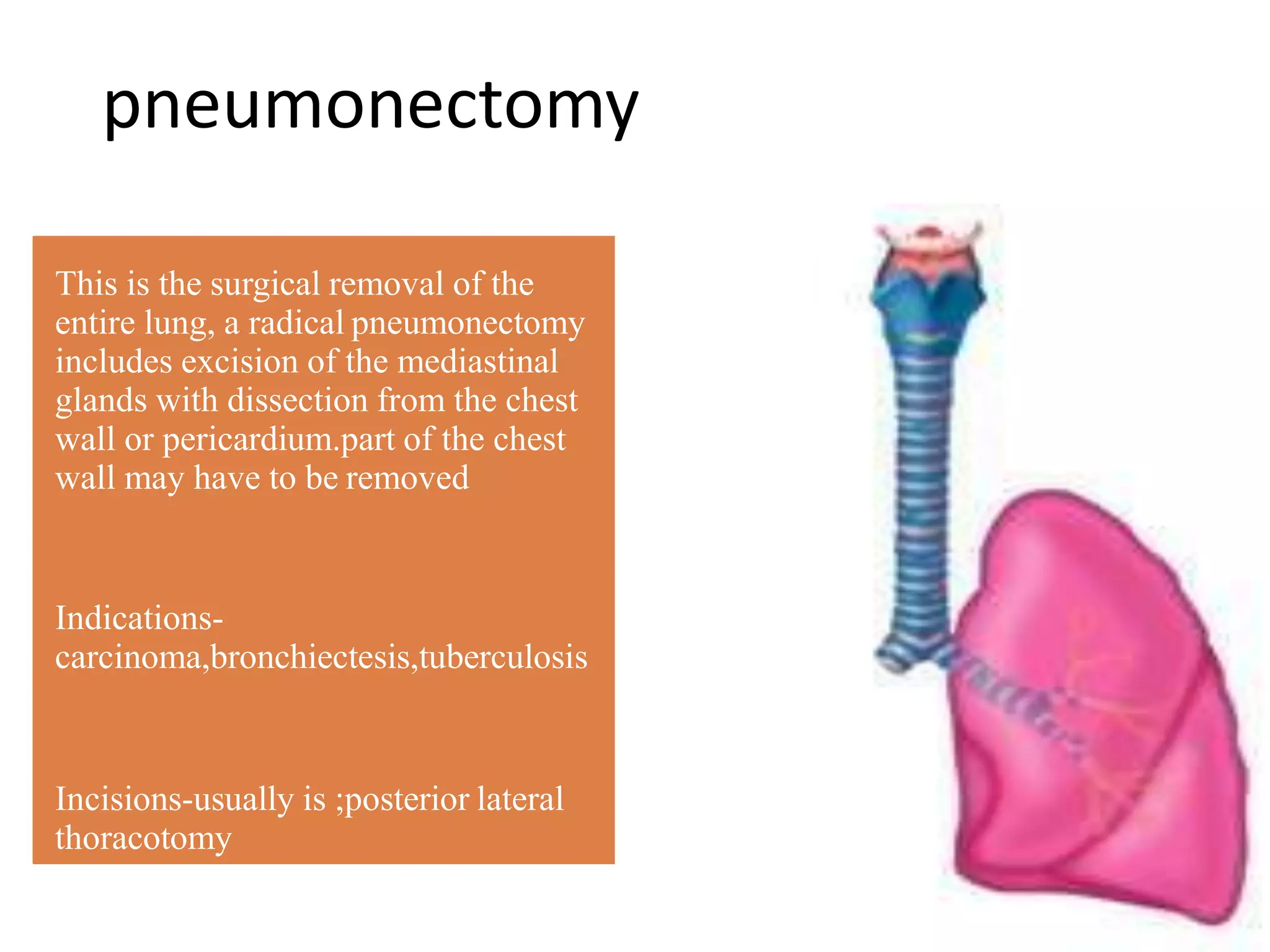 Lung resections | PPTX