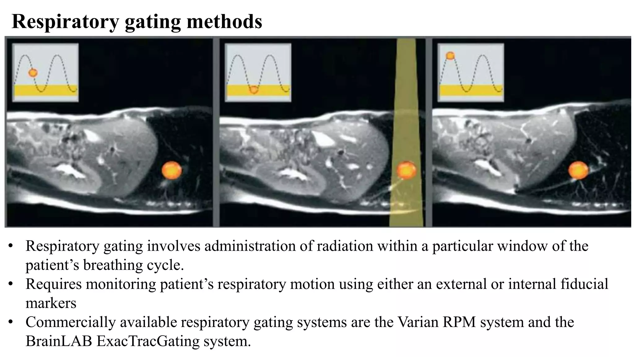 Lung sbrt ppt | PPTX | Lung and Respiratory Health | Diseases and ...