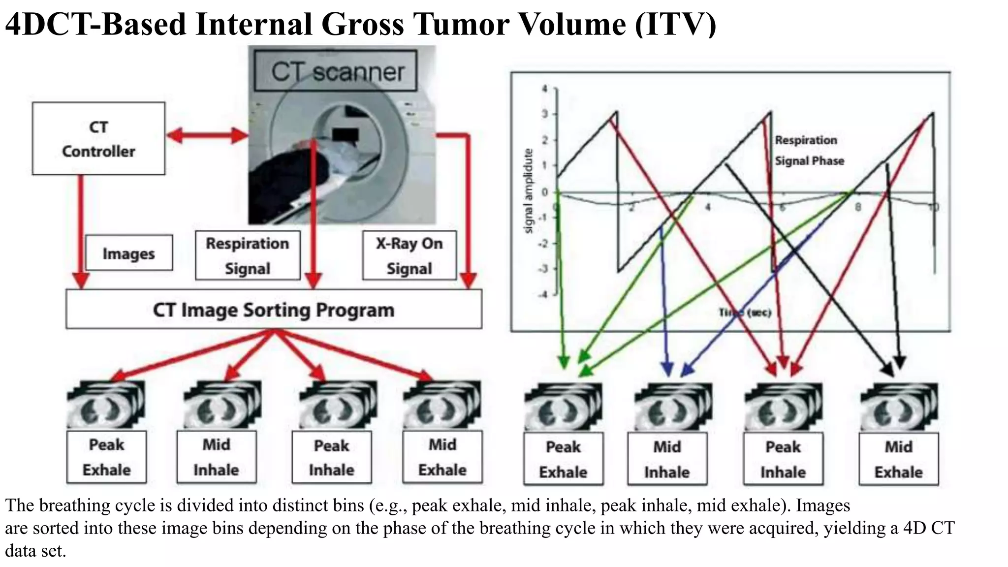 Lung sbrt ppt | PPTX