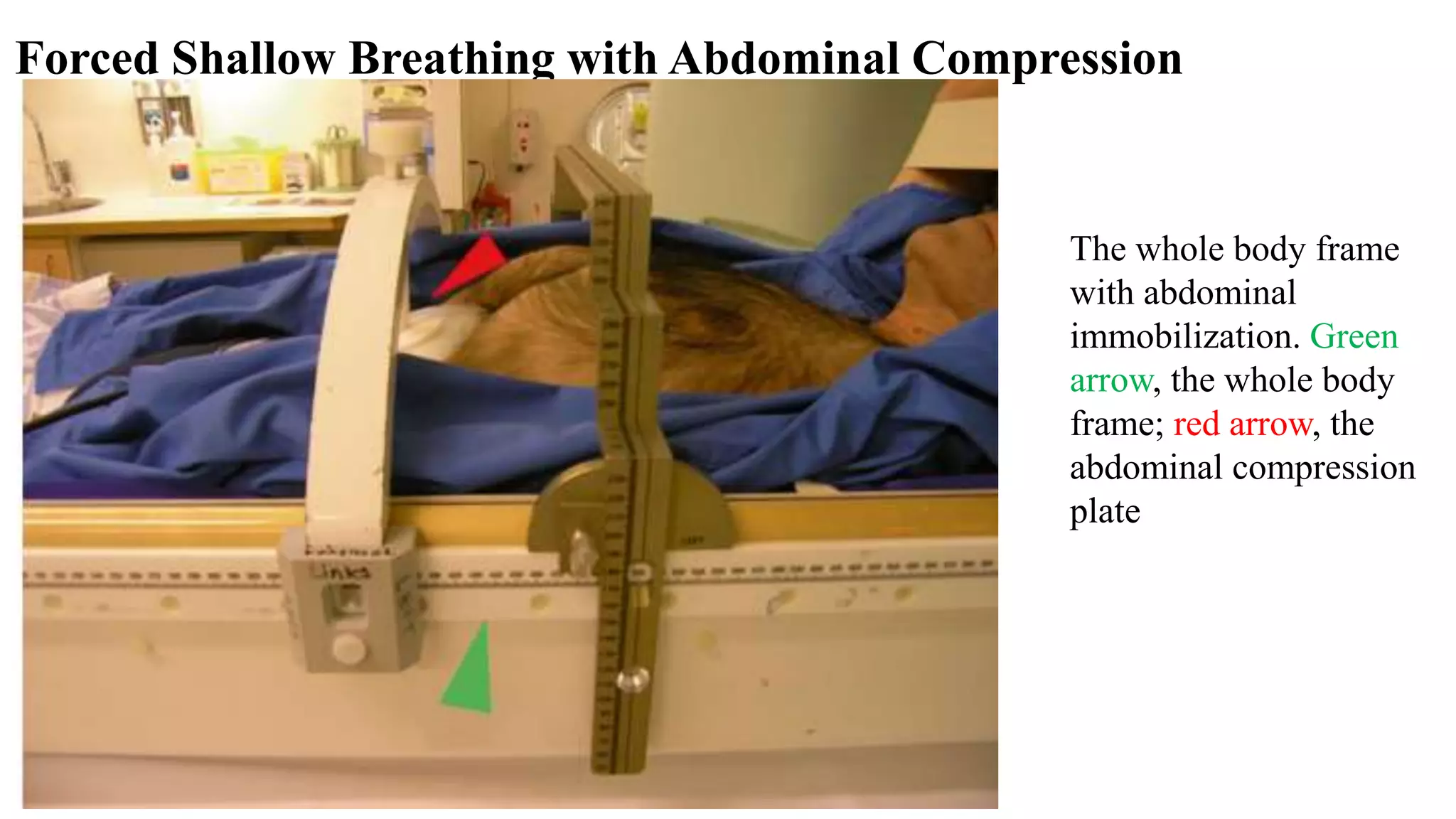 Lung sbrt ppt | PPTX