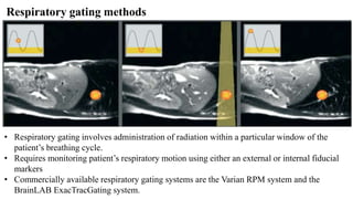 Lung sbrt ppt | PPTX