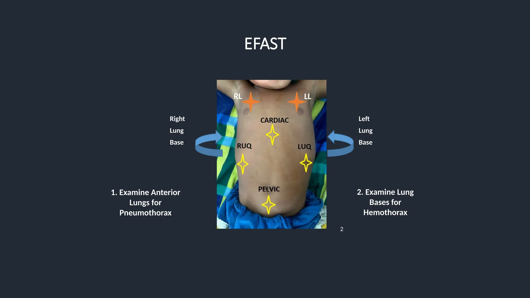 Lung Sonography for FAST ......exam.pptx