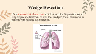 Various surgeries involving Lung, entirely and partially | PPTX