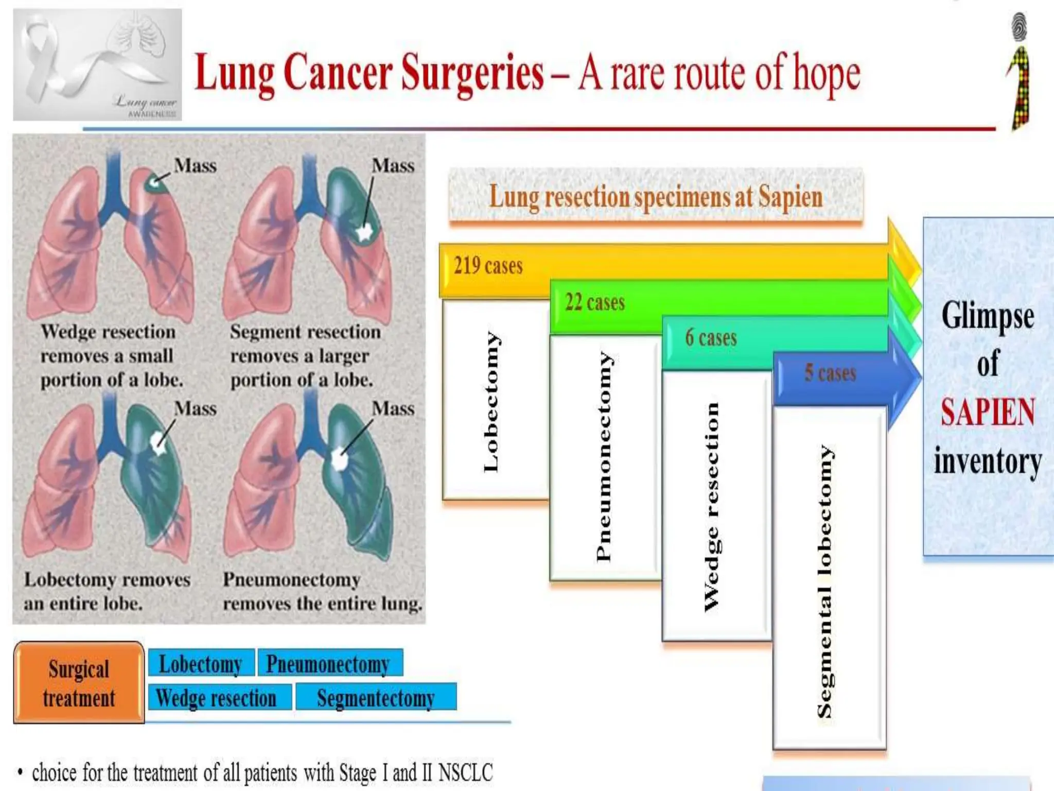 LUNG SURGERIES BY DR HEMANG JANI MPT CARDIO.pptx