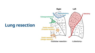 Lung transplantation and its complications | PPTX