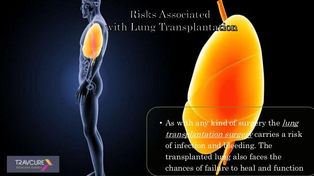 Lung transplantation surgery
