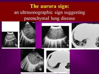 Lung Ultrasound | PDF