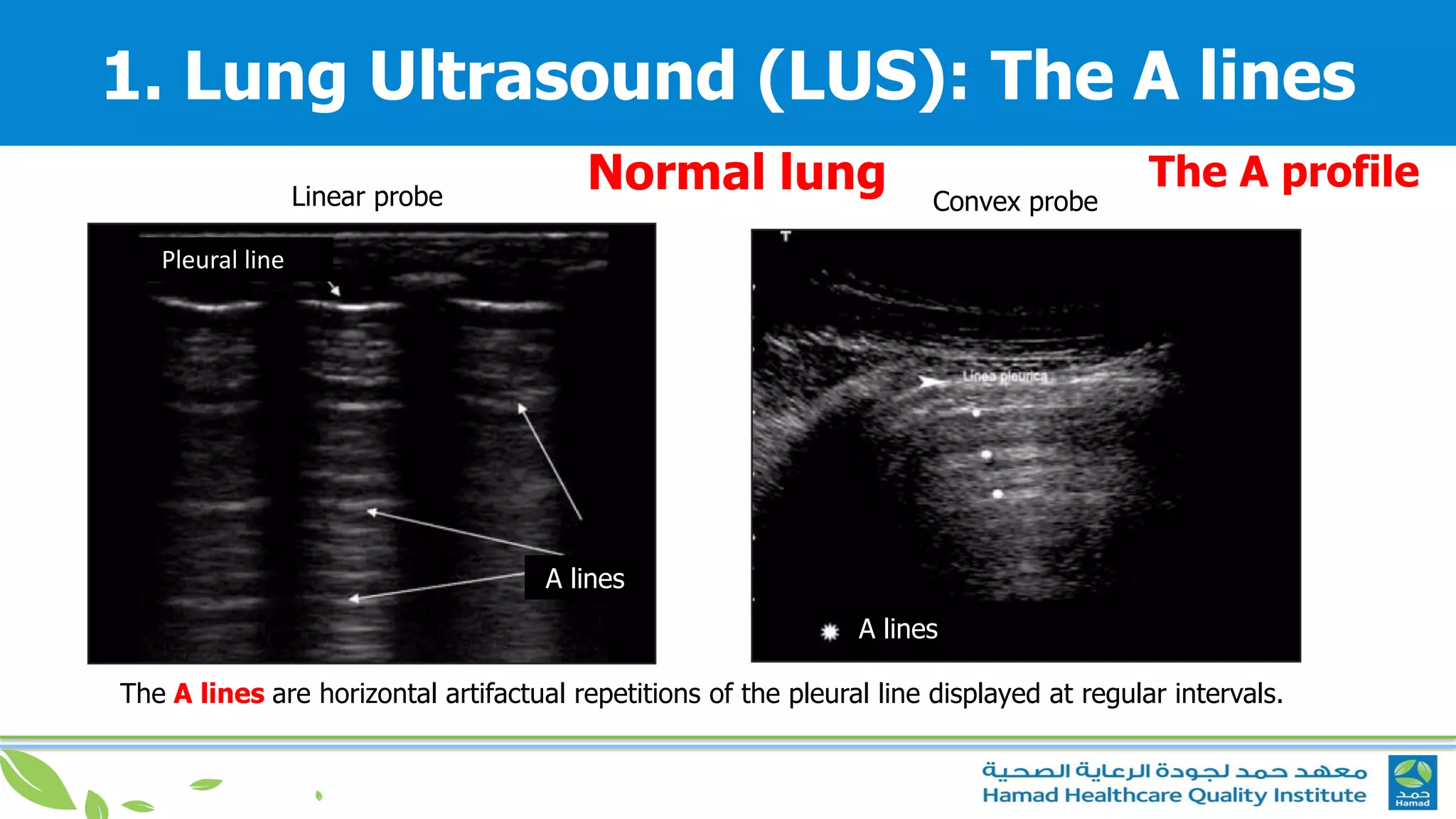 Lung ultrasound.pdf