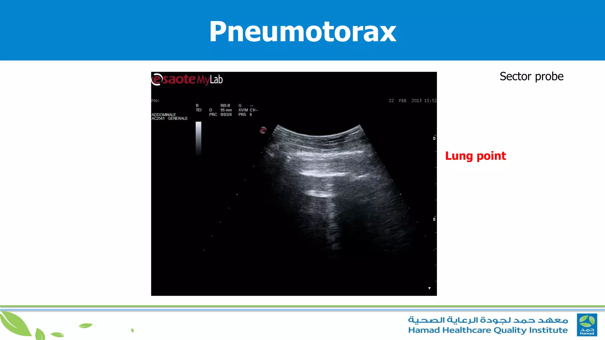 Lung ultrasound.pdf