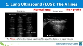 Lung ultrasound.pdf