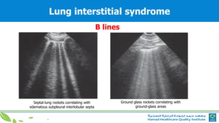 Lung ultrasound.pdf