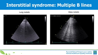 Lung ultrasound.pdf