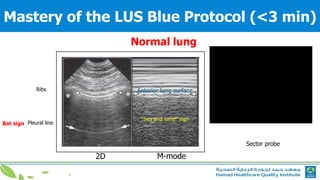 Lung ultrasound.pdf