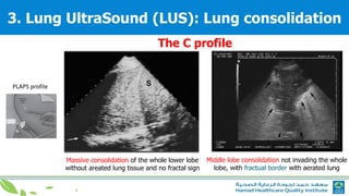 Lung ultrasound.pdf