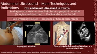 Lung Ultrasound and Abdominal Ultrasound.pptx