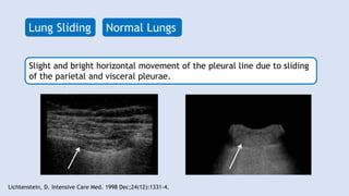 Lung Ultrasound in Cardiac Care | PPTX