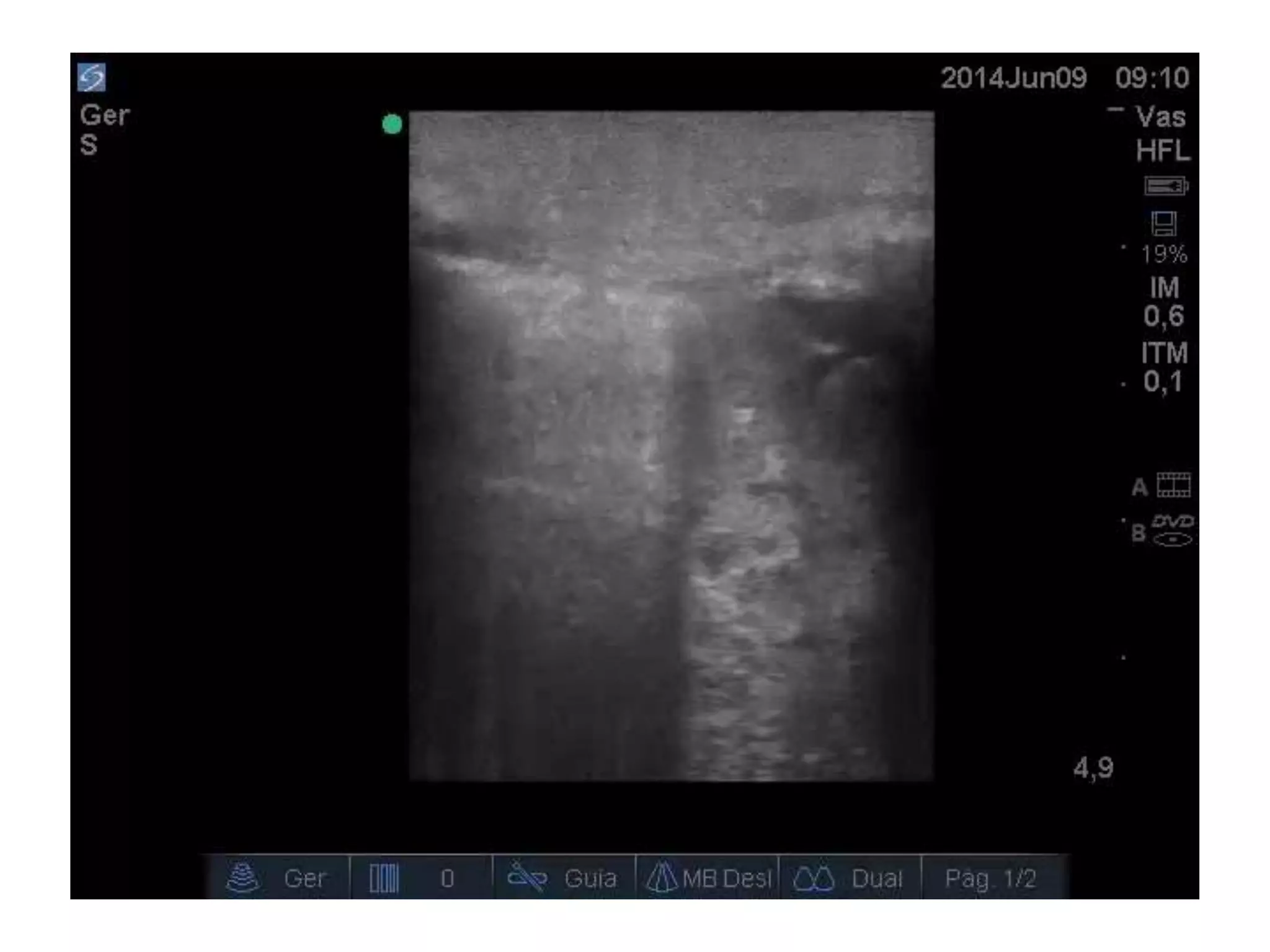 Principles of Lung Ultrasound | PPTX