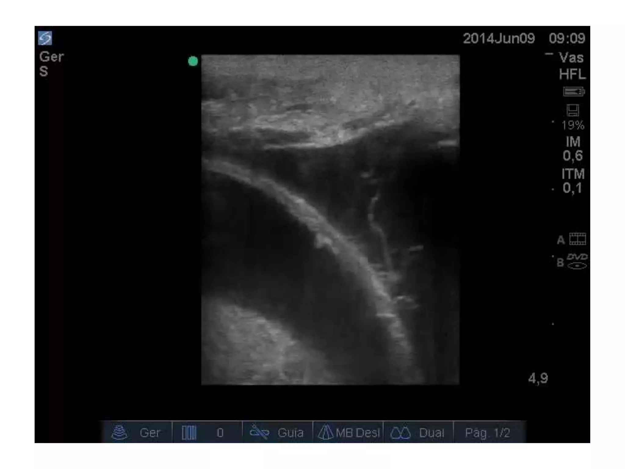 Principles of Lung Ultrasound | PPTX