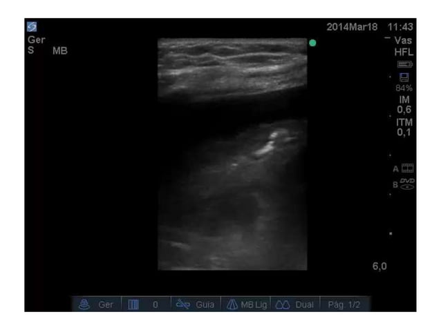 Principles of Lung Ultrasound | PPTX