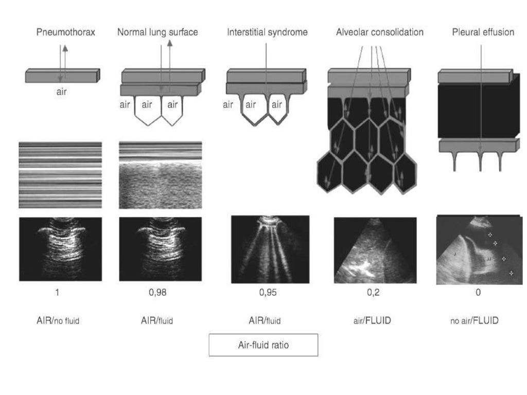 Principles of Lung Ultrasound
