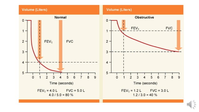 Lung volume and capacity | PPTX | Lung and Respiratory Health ...