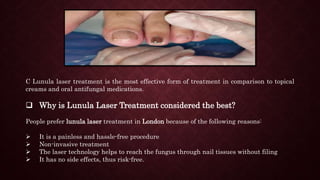 Lunula Laser in London - The Most Effective Treatment to Fungal Foot ...