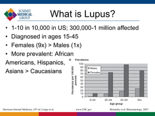 Lupus | PDF