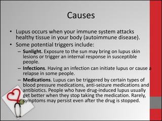 Lupus | PDF