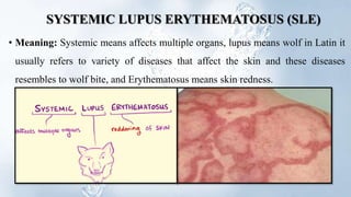 Lupus | PPTX | Menopause | Endocrine and Metabolic Diseases
