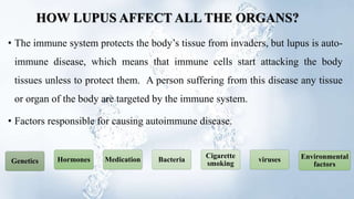 Lupus | PPTX | Menopause | Endocrine and Metabolic Diseases