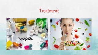 LUPUS.pptx