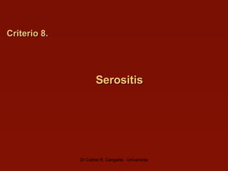 Lupus Eritematoso Sistemico | PPS