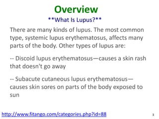 Lupus | PPTX