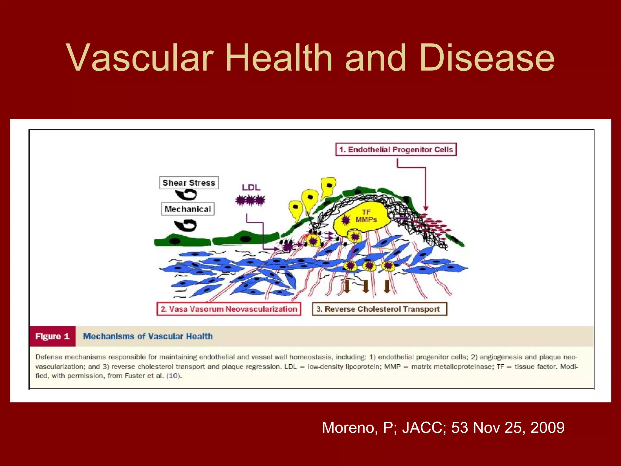 Lupus and cardiovascular disease | PPT