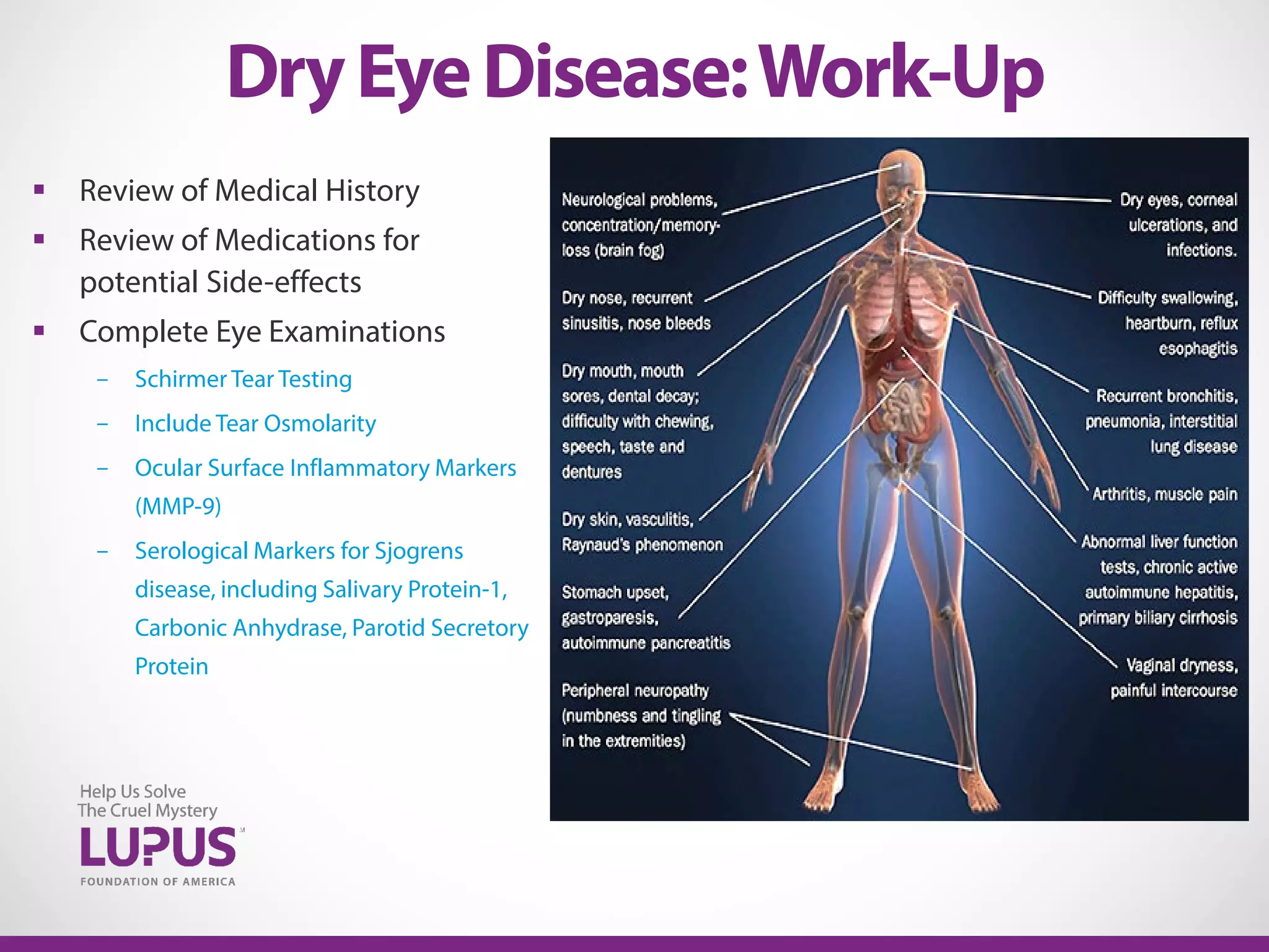Lupus and the Eye | PDF